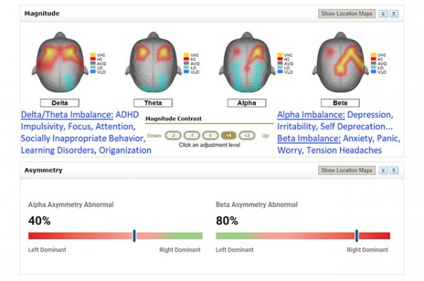 Sunshine Neurofeedback - Treatment by Brain Mapping/Training